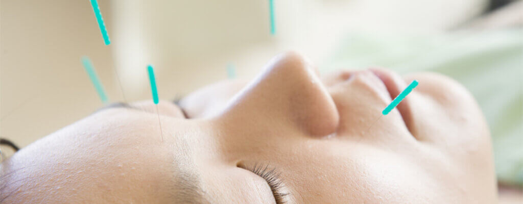 Dry Needling/IMS Treatment South Edmonton and West Edmonton